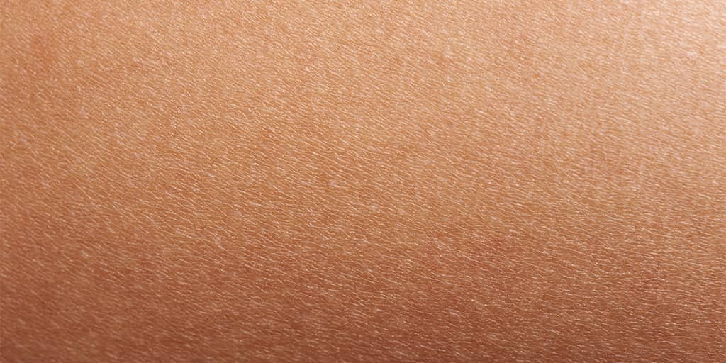 How to differ atopic eczema from dry skin? | La Roche Posay Africa