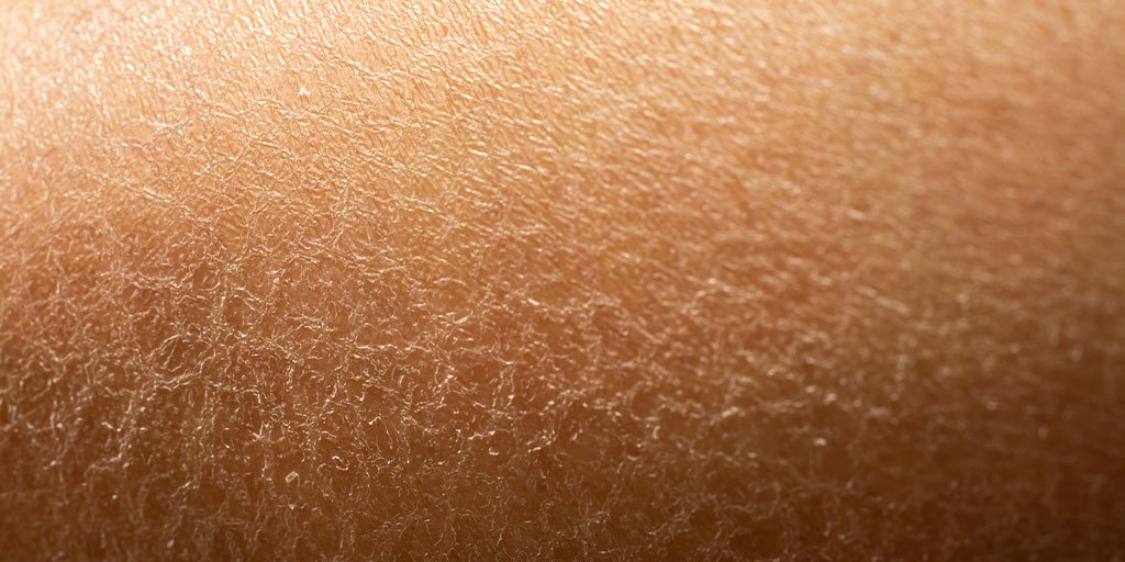 All You Need to Know About Sensitive Skin | La Roche Posay