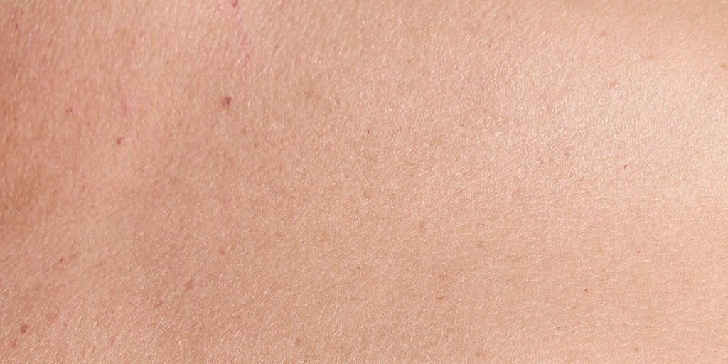 How to know if you Have Sensitive Skin? | La Roche Posay Africa